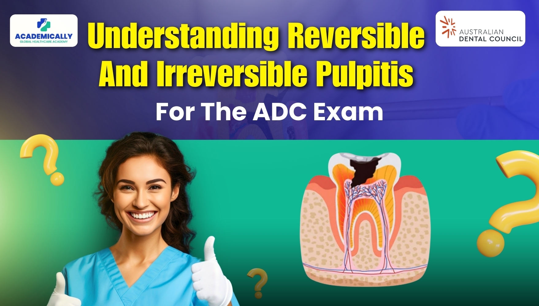 Reversible And Irreversible Pulpitis For ADC Exam | Academically Global