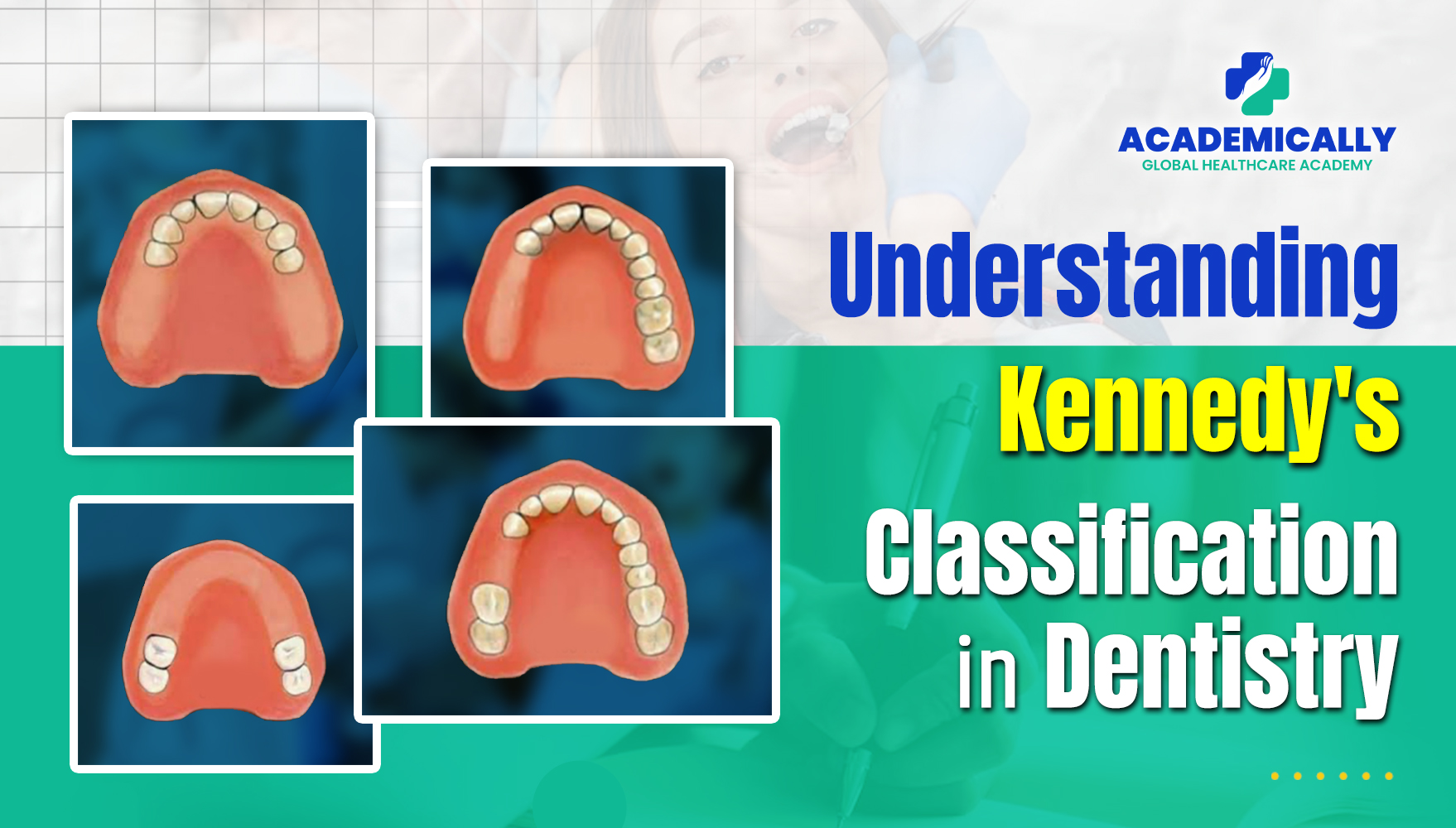Understanding Kennedy's Classification in Dentistry | Academically Global